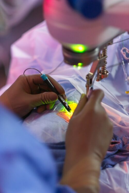 Retina Surgery Atlanta | Retina Specialist | Georgia Retina